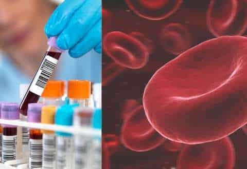 DNA Wellness Test - Best DNA Home test kit Provider in GCC